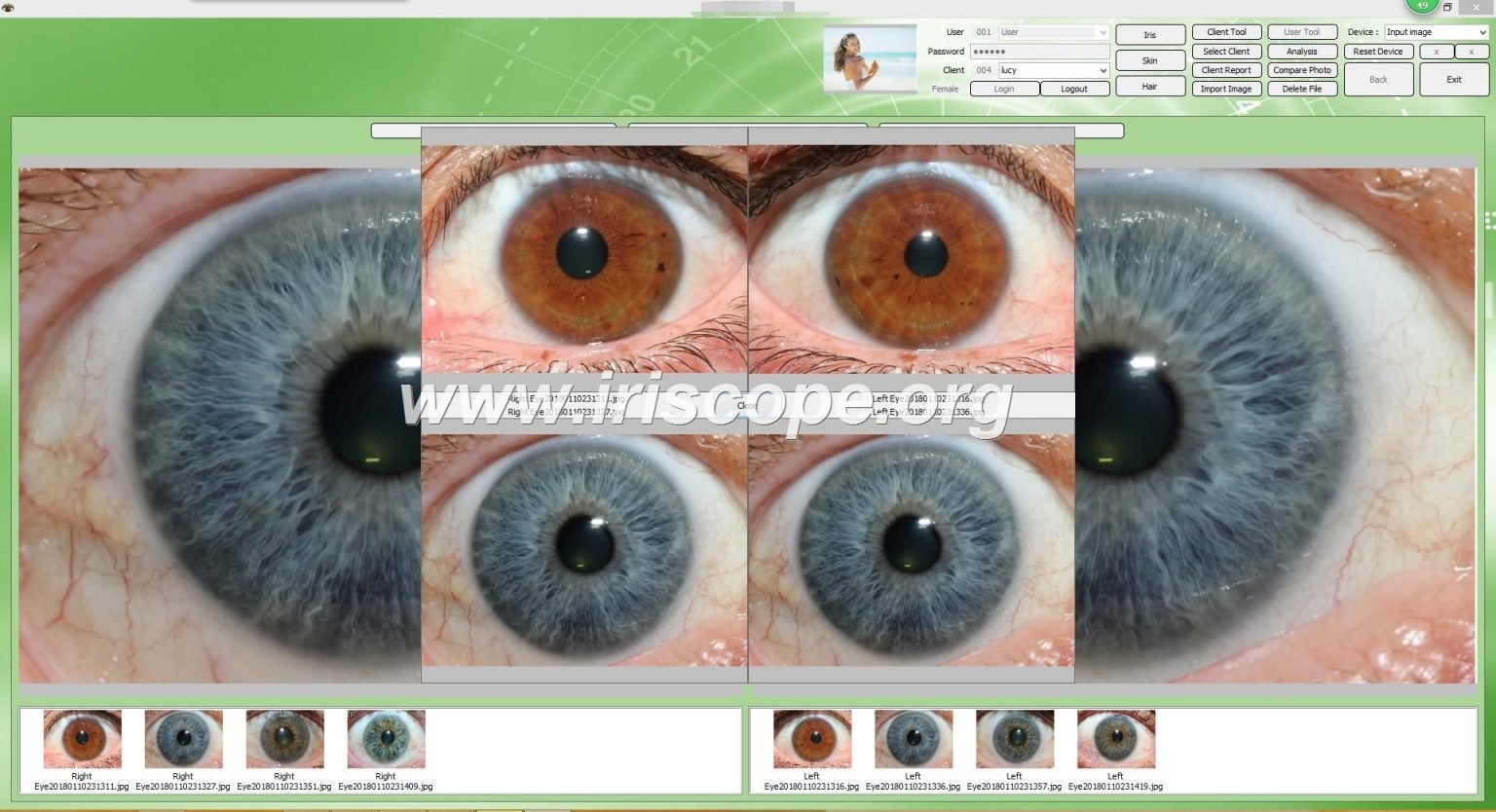 What Is An Iridology Chart? – Maikong Iridology Pictures And Meanings