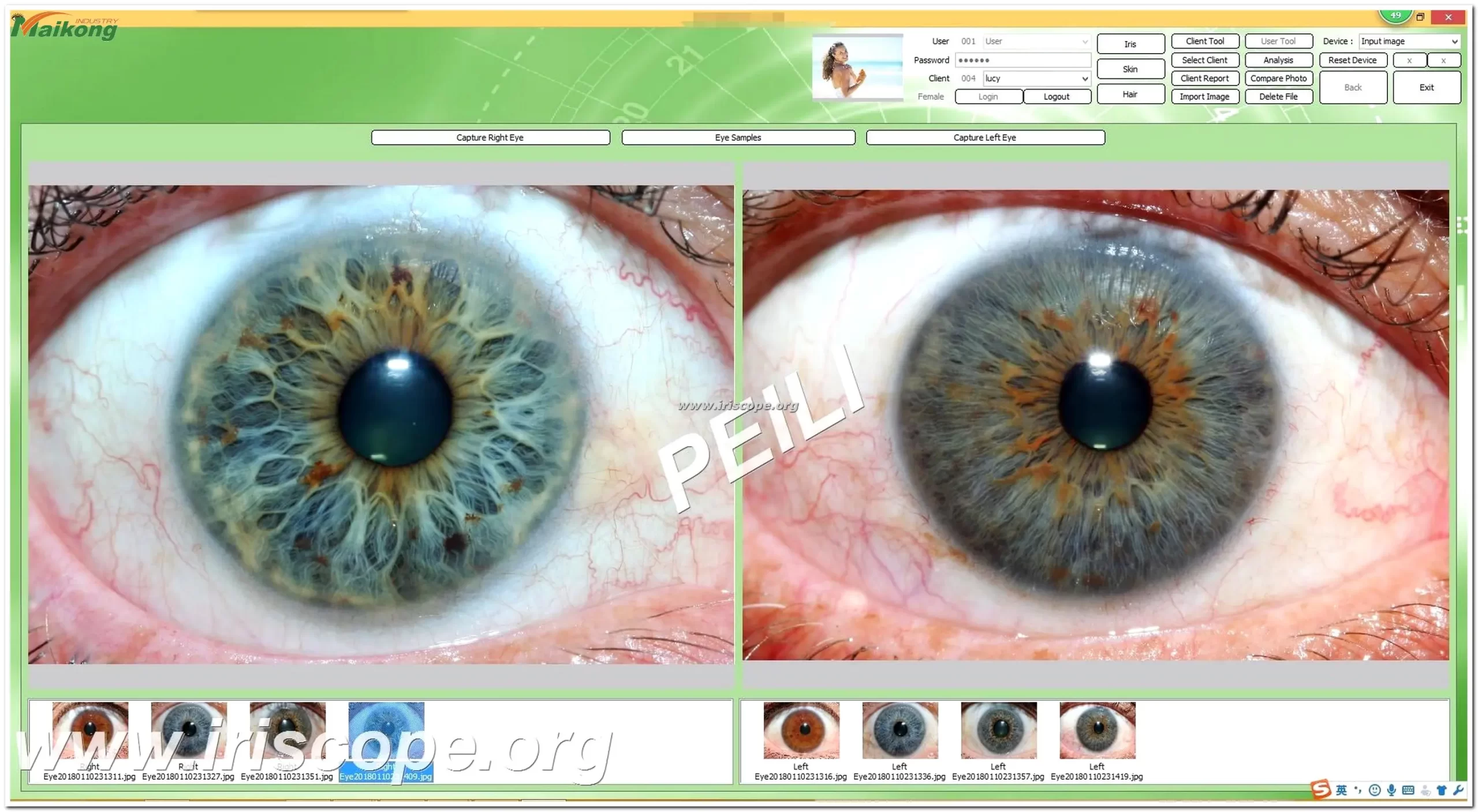 Bernard Jensen Iriscope: The Cutting-Edge MK9822 Iridology Camera ...