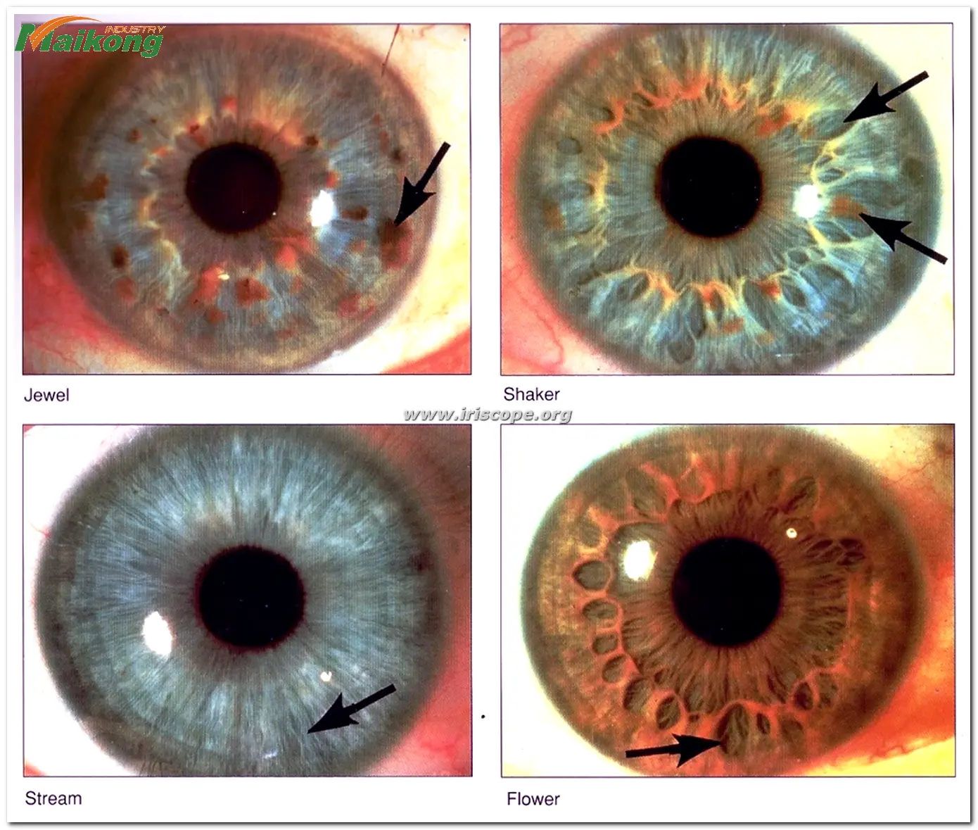 Tyler Tolman Iriscope: A Comprehensive Guide To MAIKONG's Iridology ...